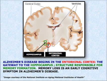 The Alzheimer Brain – Dementia Awareness Research Group of Trinidad ...